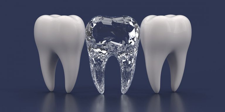 Diamond Tooth Implants - The Celebs That Have Them - Summerlea Dental