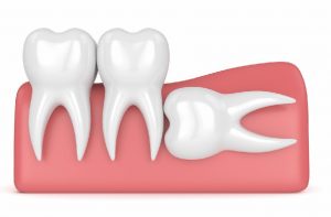 Teeth in Bizarre Places - Summerlea Dental